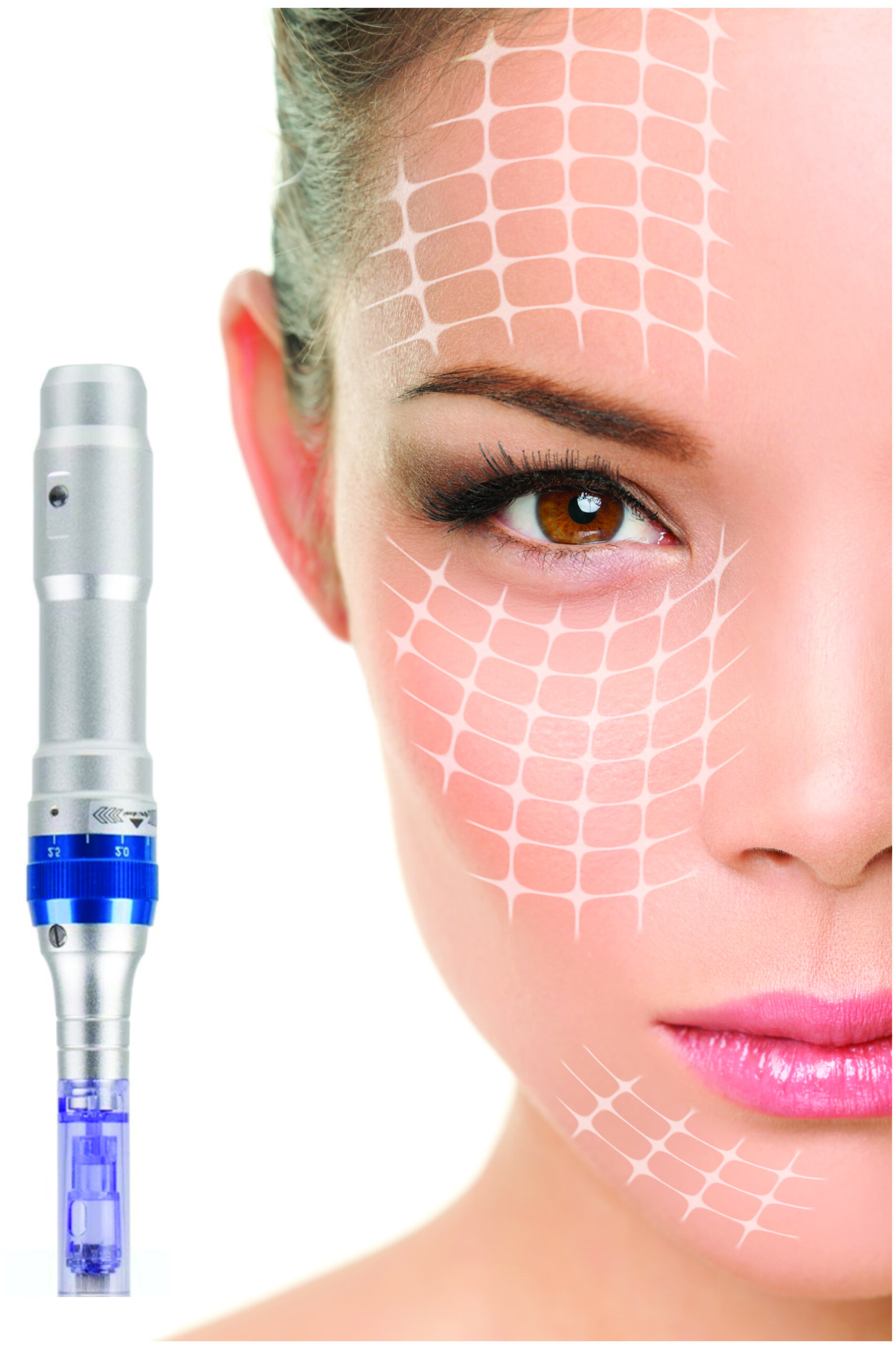 Micro Needling